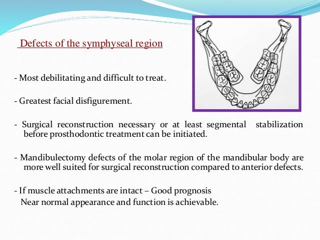 Management of aquired mandibular defect / mandible defect management