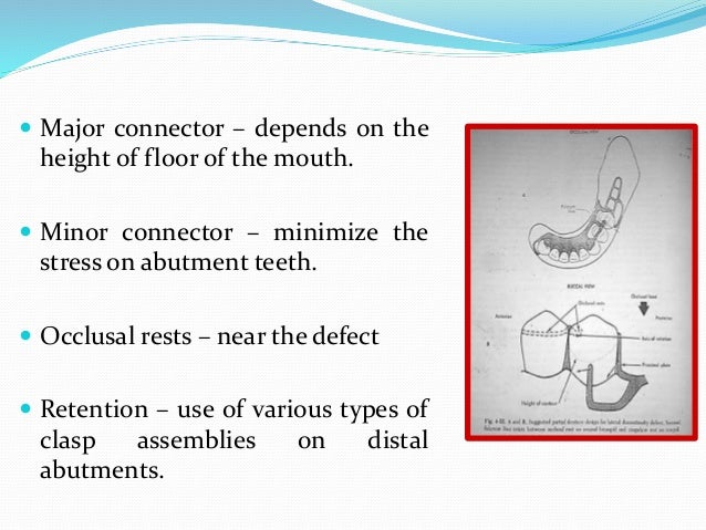 Management of aquired mandibular defect / mandible defect management