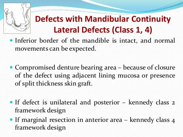 Management of aquired mandibular defect / mandible defect management