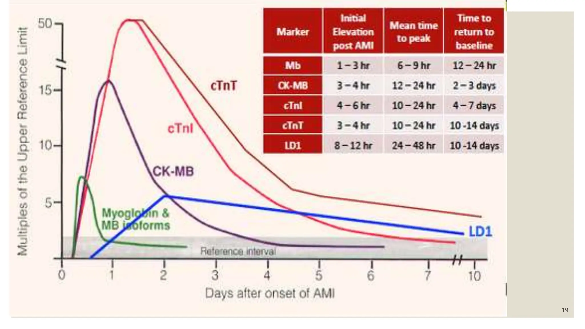 Pemeriksaan CKMB CK LDH- Responsi kuliah.pptx