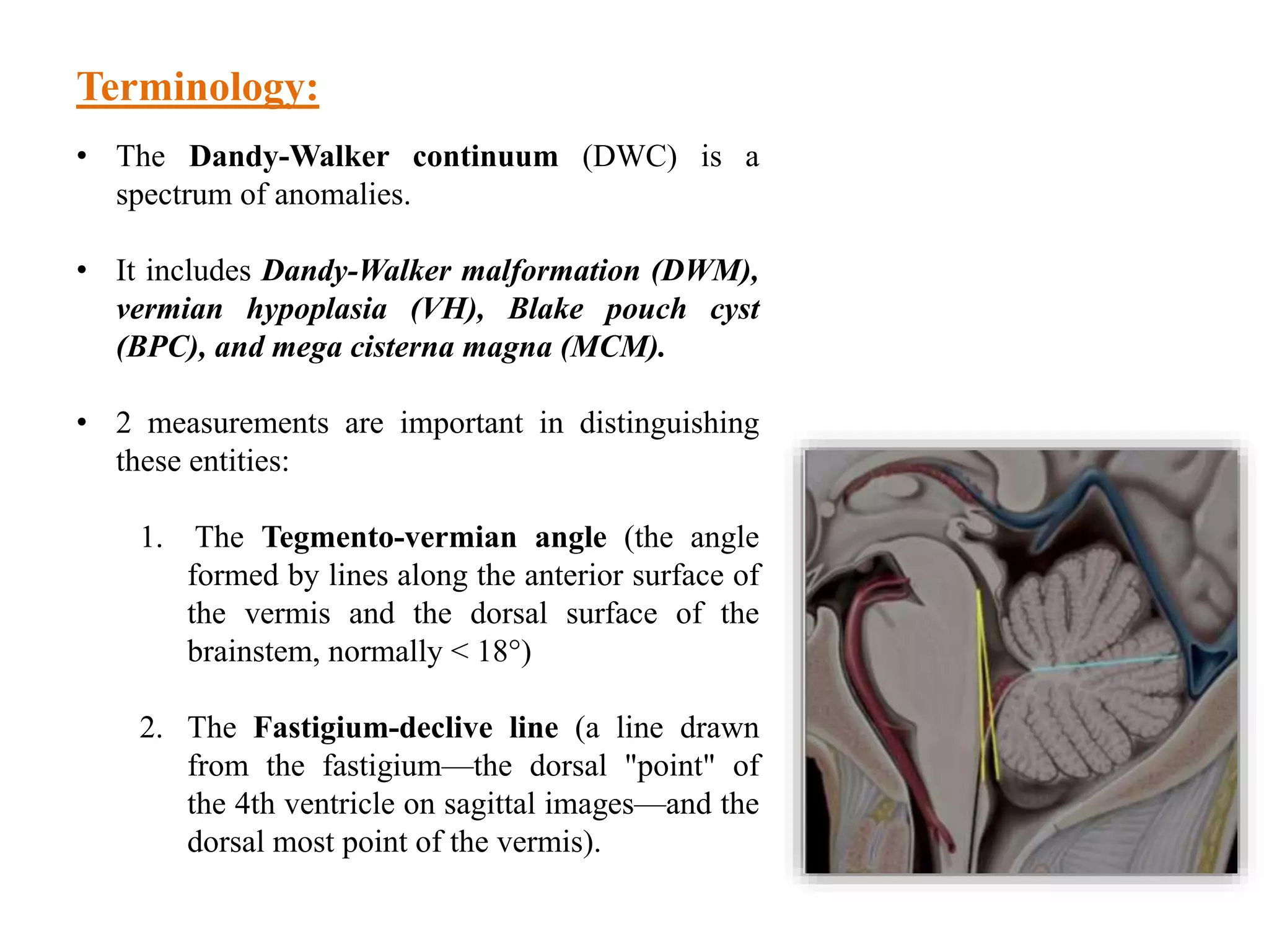 Dandy-Walker Malformation: Classification and Management | PPTX
