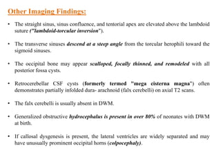 Dandy-Walker Malformation: Classification and Management | PPTX
