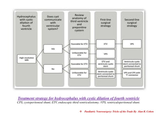 Dandy-Walker Malformation: Classification and Management | PPTX