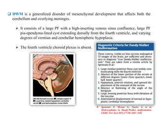 Dandy-Walker Malformation: Classification and Management | PPTX