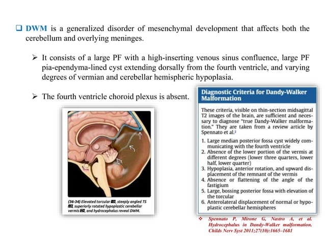 Dandy-Walker Malformation: Classification and Management | PPT
