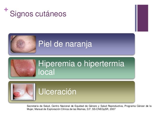 Diagnóstico cáncer de mama