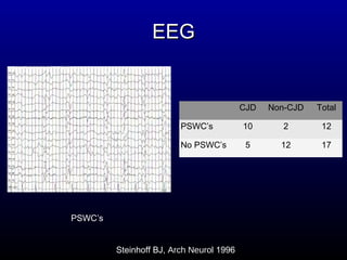 Diagnosis of Creutzfeldt-Jakob Disease | PPT