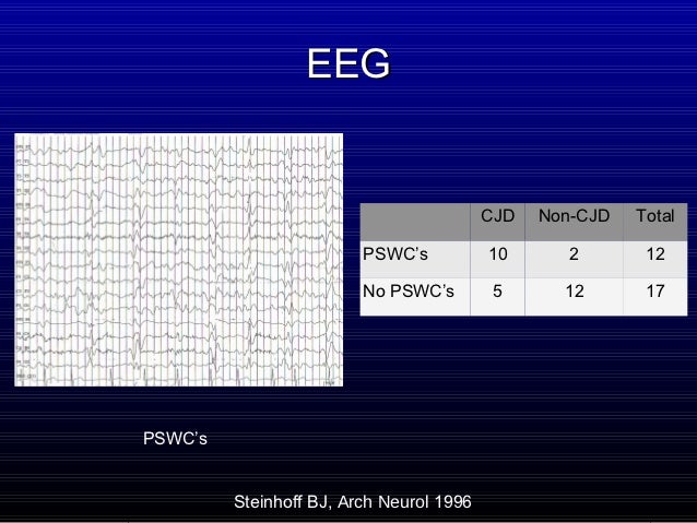 Diagnosis of Creutzfeldt-Jakob Disease