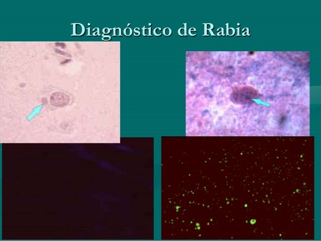 Rabia Diagnóstico y Control