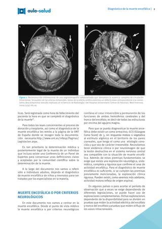 Dx de muerte encefalica | PDF