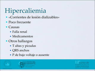 Dx Diferencial de Elevación del ST | PPT