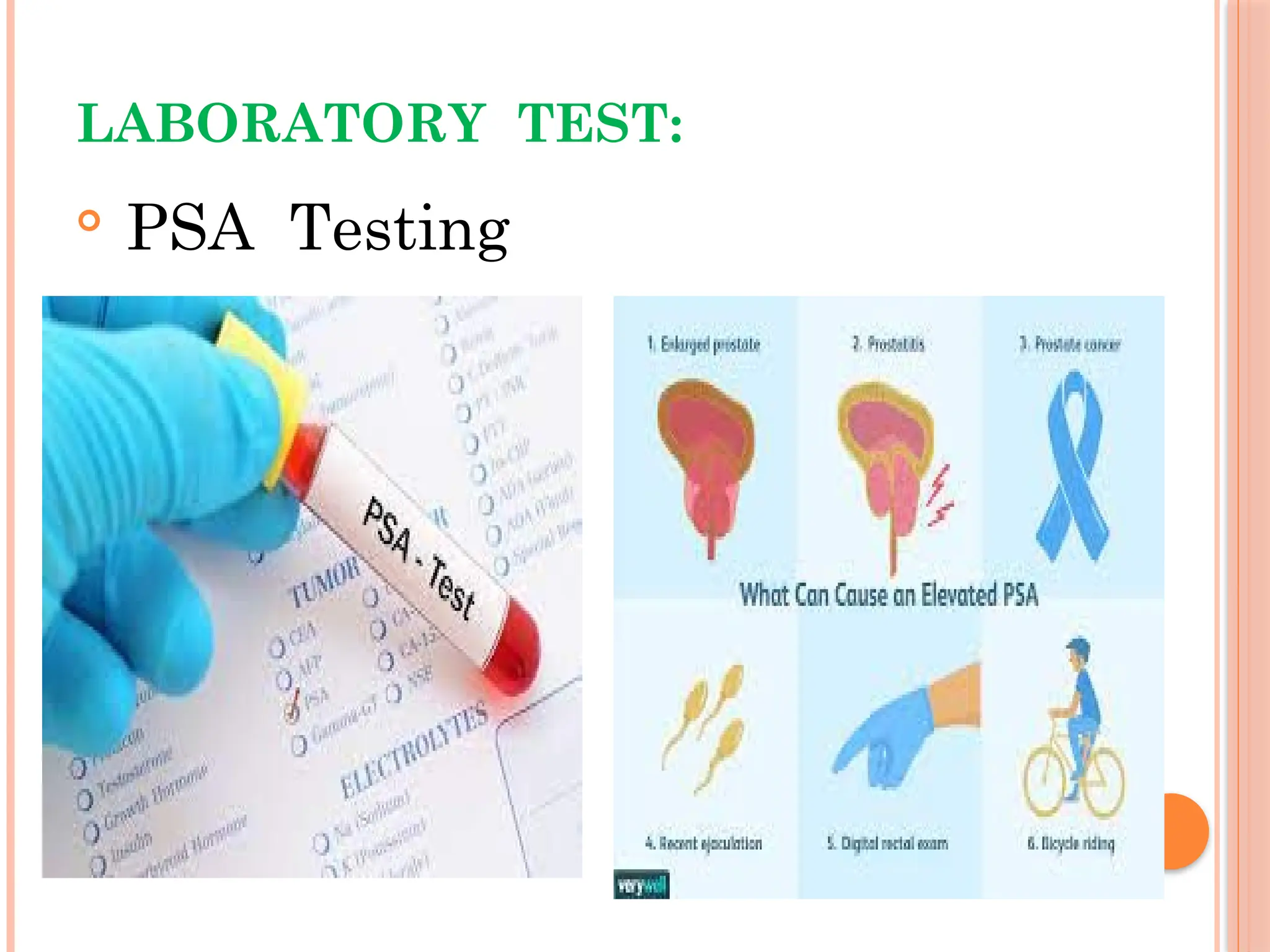 Diagnostic evaluation of Male Reproductive System | PPTX