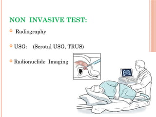 Diagnostic evaluation of Male Reproductive System | PPTX