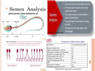 Diagnostic evaluation of Male Reproductive System | PPT