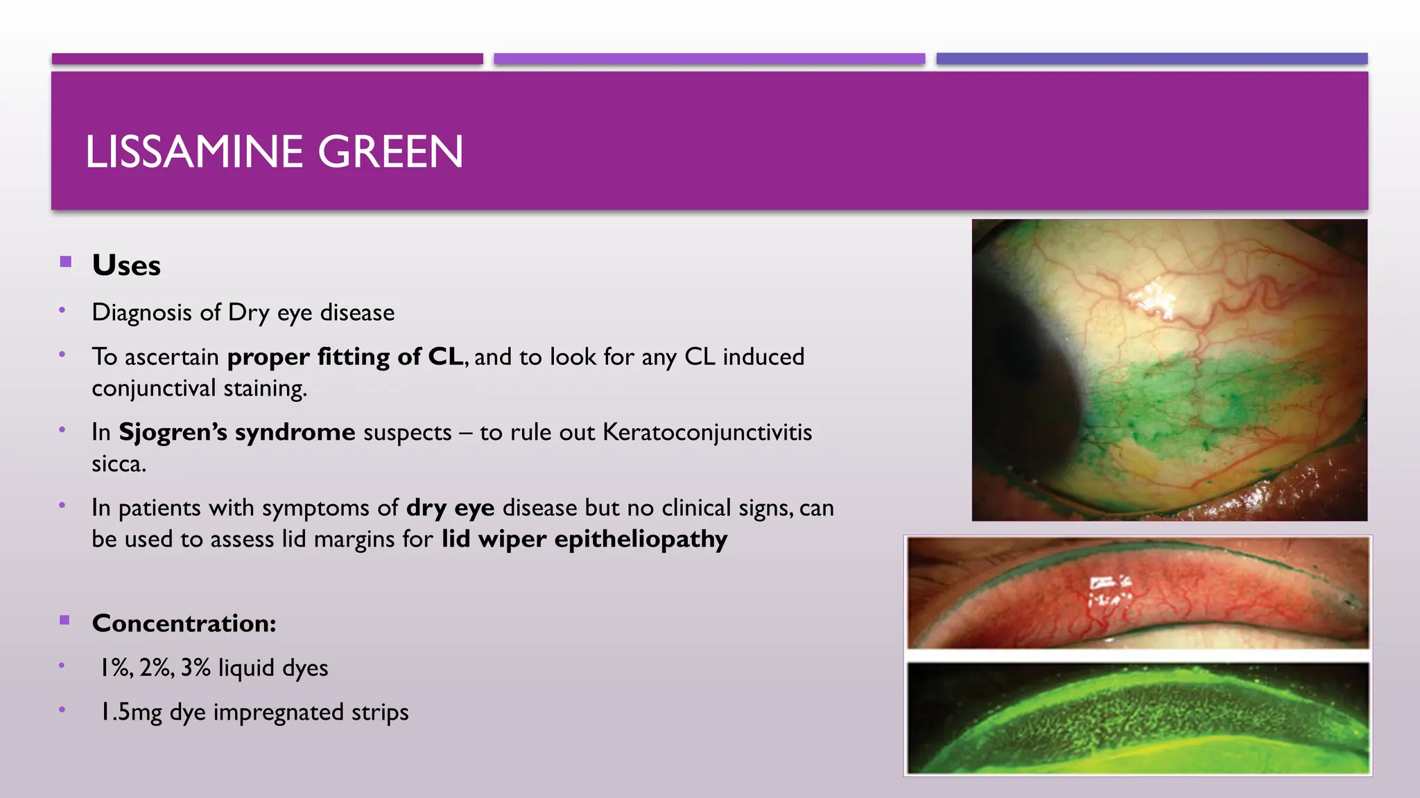 DYES IN OPHTHALmology powerpoint ppt.pptx