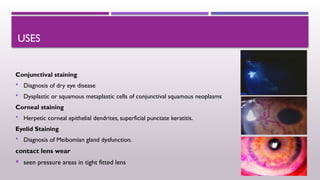DYES IN OPHTHALmology powerpoint ppt.pptx