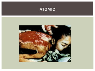 Atomic Bomb Photo Essay | PPTX