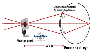 BASICS DYNAMIC AND STATIC RETINOSCOPY... | PPTX