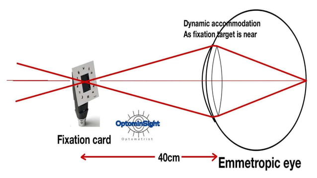 BASICS DYNAMIC AND STATIC RETINOSCOPY... | PPTX | Eye and Vision ...