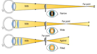 BASICS DYNAMIC AND STATIC RETINOSCOPY... | PPTX