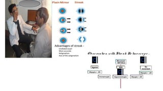 BASICS DYNAMIC AND STATIC RETINOSCOPY... | PPTX