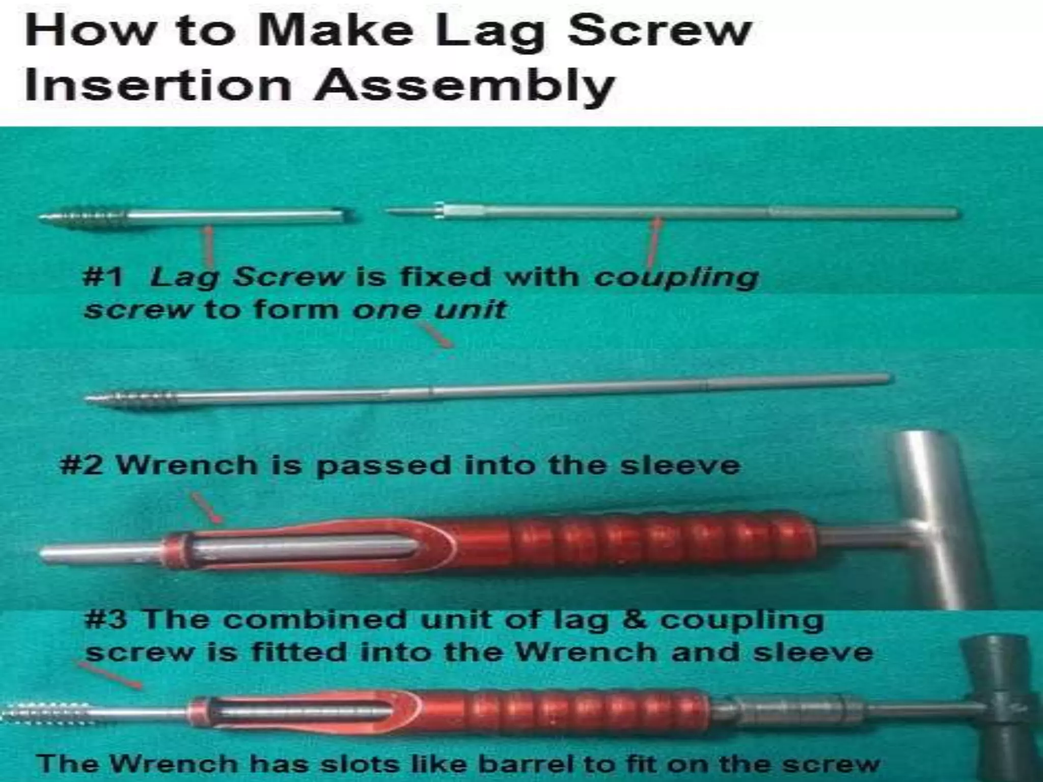 Dynamic Hip Screw Plating | PPTX