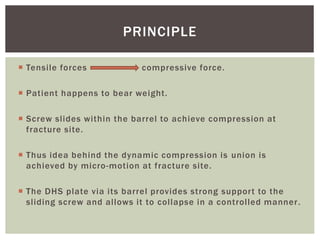 Dynamic Hip Screw Plating | PPTX