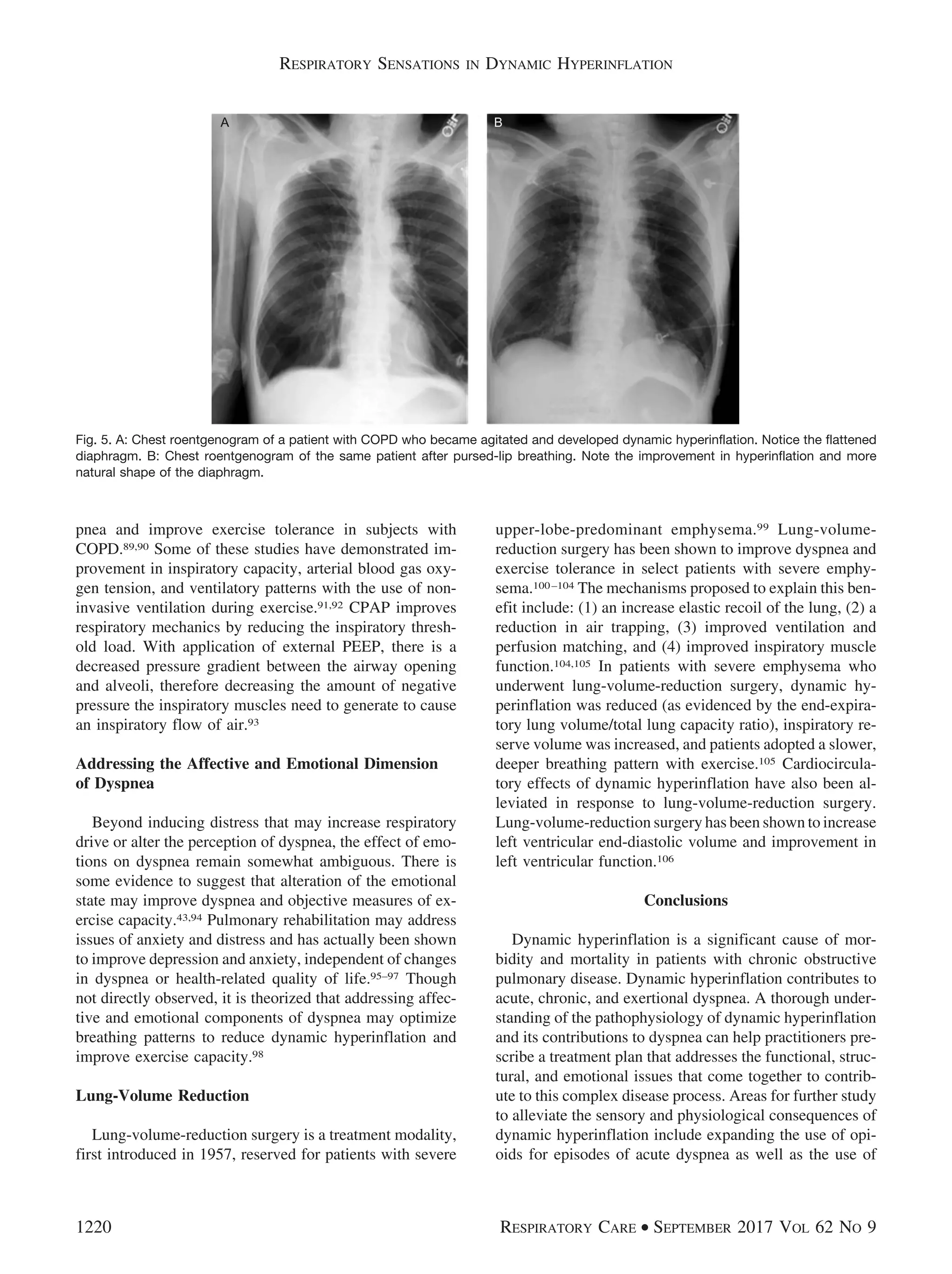 dynamic hyperinflation.pdf