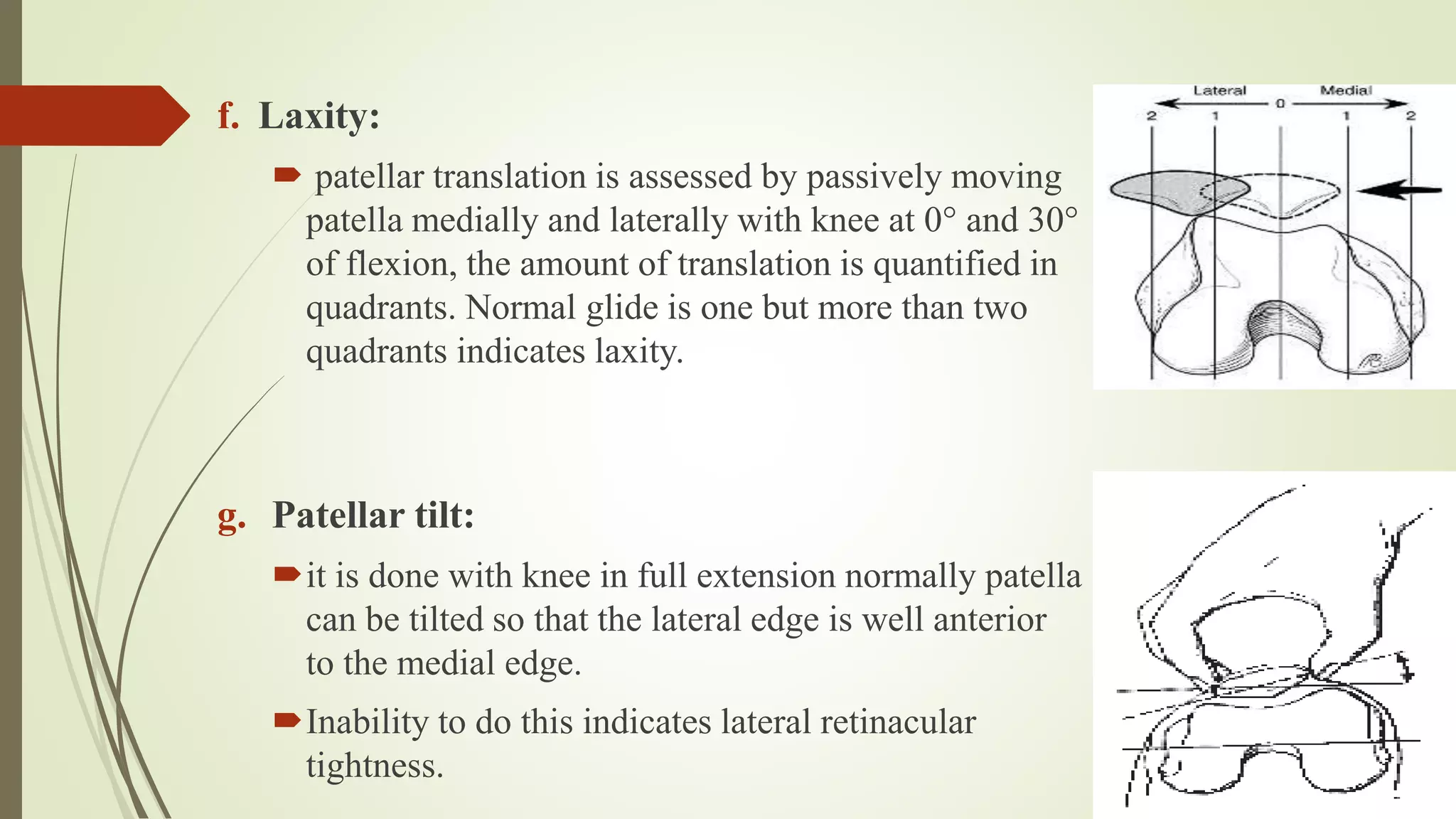 Dynamic medial patellofemoral ligament reconstruction in recurrent ...