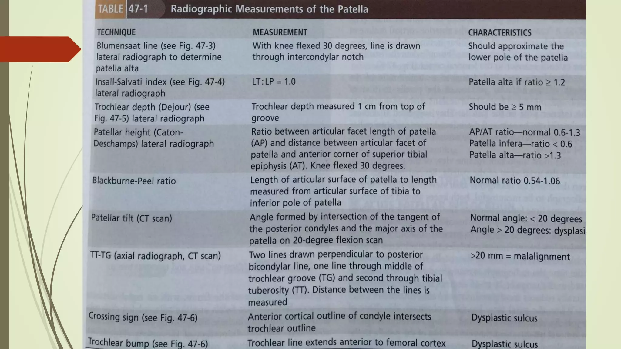 Dynamic medial patellofemoral ligament reconstruction in recurrent ...