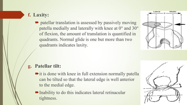 Dynamic medial patellofemoral ligament reconstruction in recurrent ...