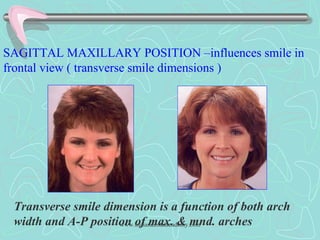 Dynamic smile /certified fixed orthodontic courses by Indian dental ...