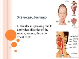 Disabilities starts with Dys | PPTX