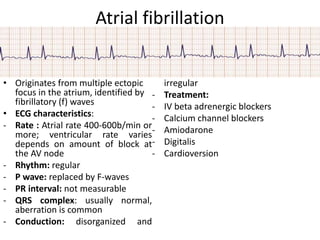 DYsrhythmia.pptx