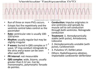 DYsrhythmia.pptx