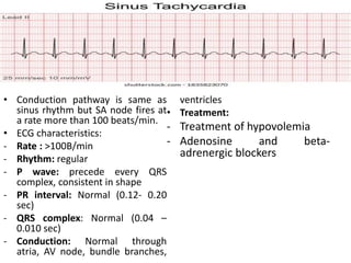 DYsrhythmia.pptx