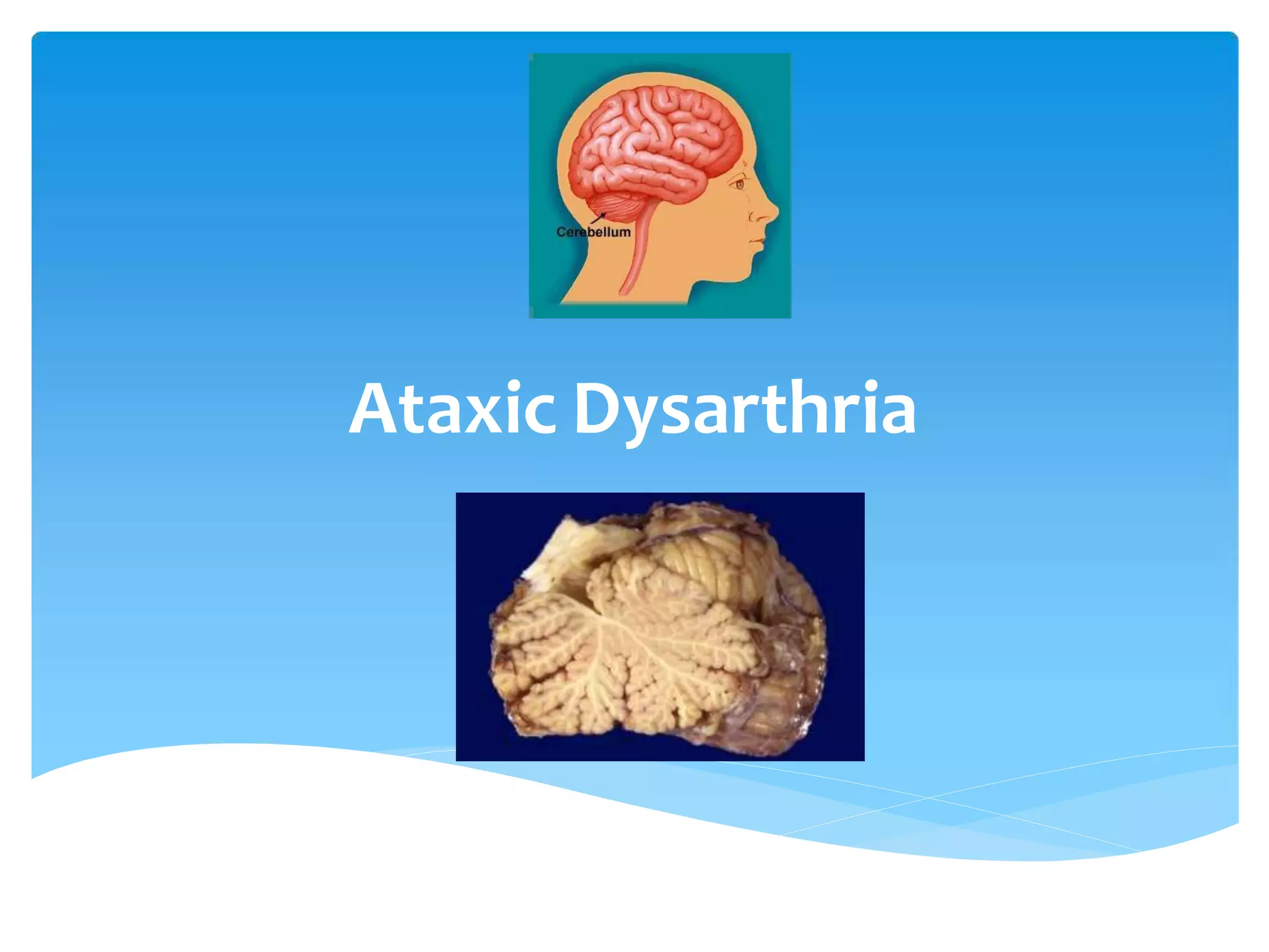 dysarthria.pptx