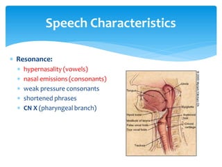 dysarthria lecture for recordin.pptx