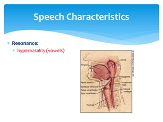 dysarthria lecture for recordin.pptx