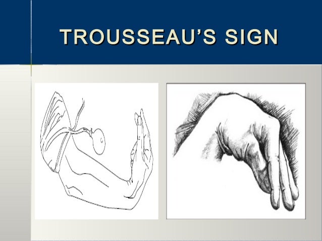 Dyselectrolytemia by Dr Sheikh Tufail
