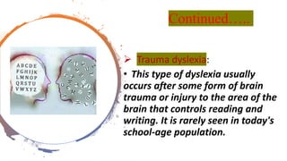 D yselixa (reading ,writing and spell disability) | PPTX