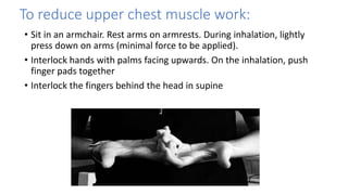 Dysfunctional breathing | PPTX