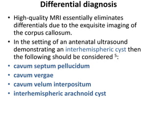 Dysgenesis of the corpus callosum | PPTX