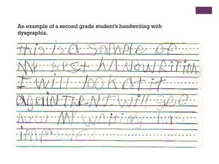 Dysgraphia | PPT | Brain and Nervous System Disorders | Diseases and ...