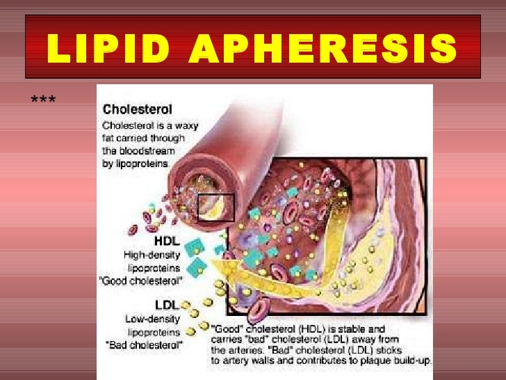 Dyslpidemia Cme Com 25 May09