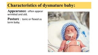 Dysmaturity.pptx