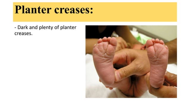 Dysmaturity.pptx | Pregnancy | Reproductive Health