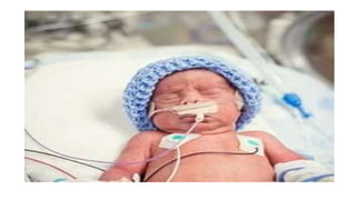 Dysmaturity.pptx