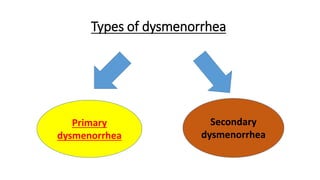 Dysmenorrhea | PPTX