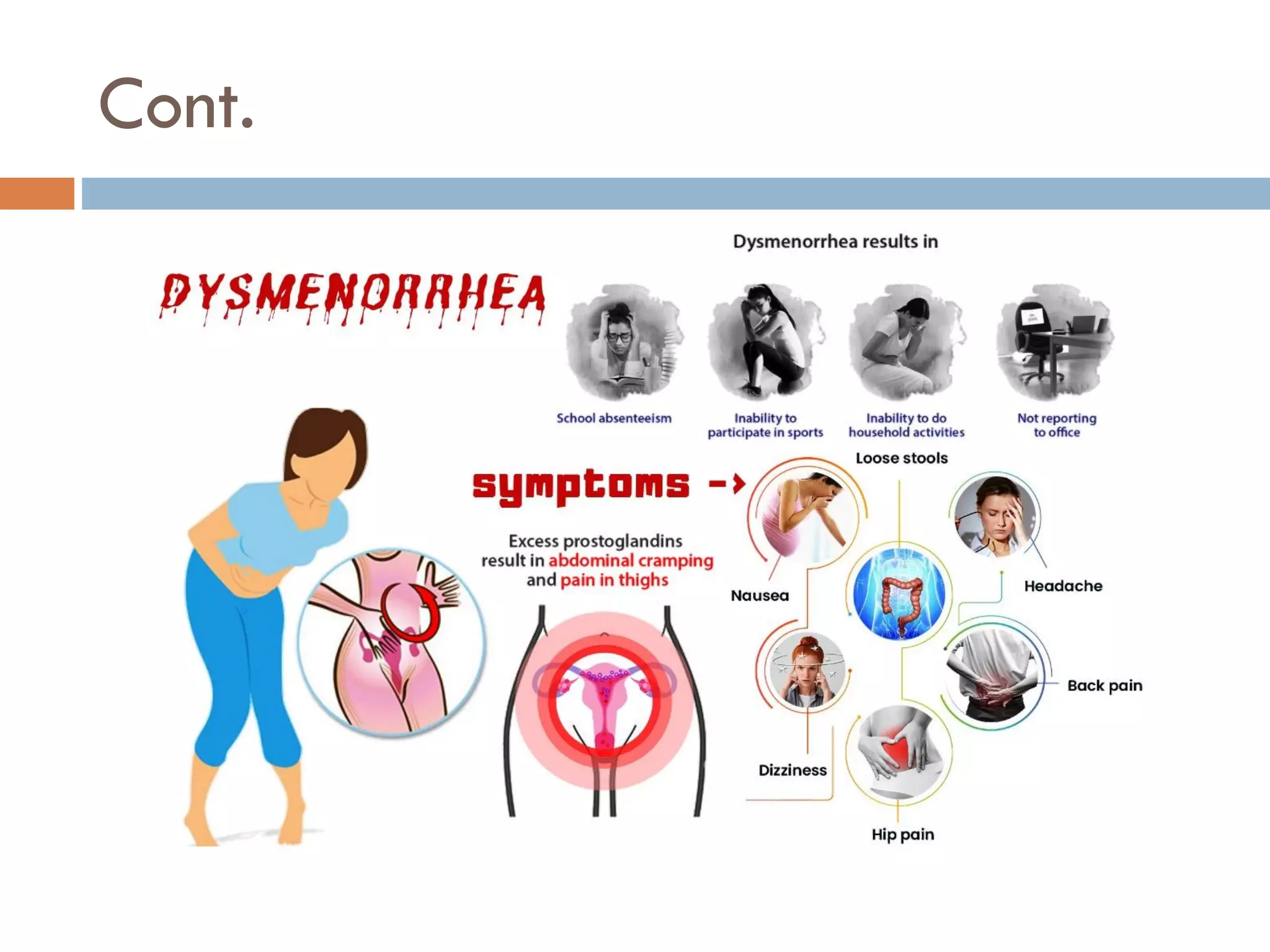 Dysmenorrhoea | PDF